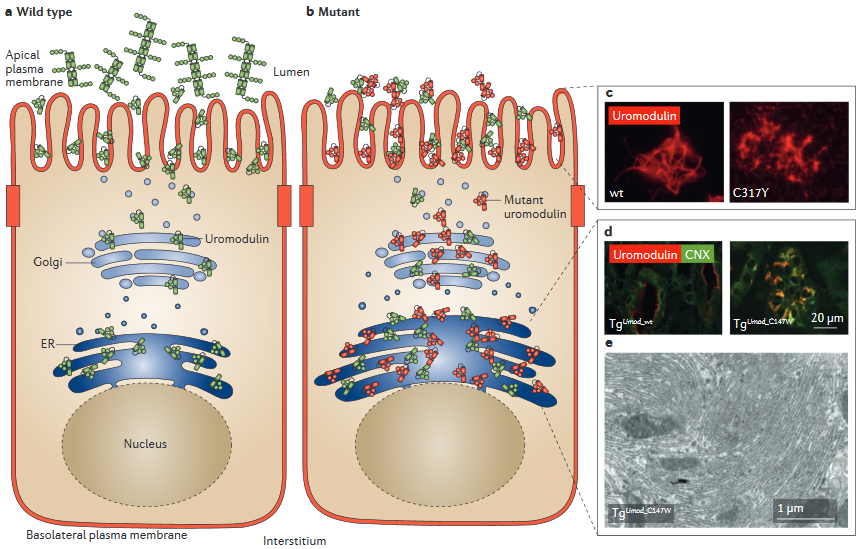 A Very Personal History of Uromodulin | Brian Muchmore